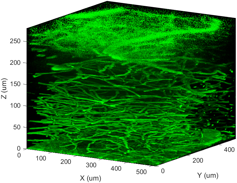 GitHub - Achuan-2/volume_view: 用matlab绘制3d volume