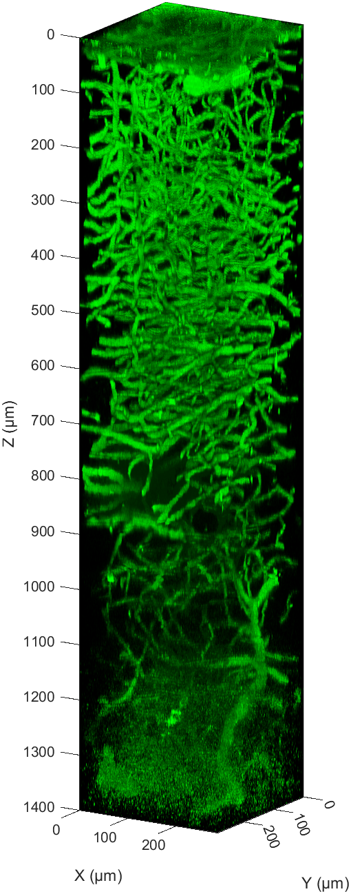 GitHub - Achuan-2/volume_view: 用matlab绘制3d volume